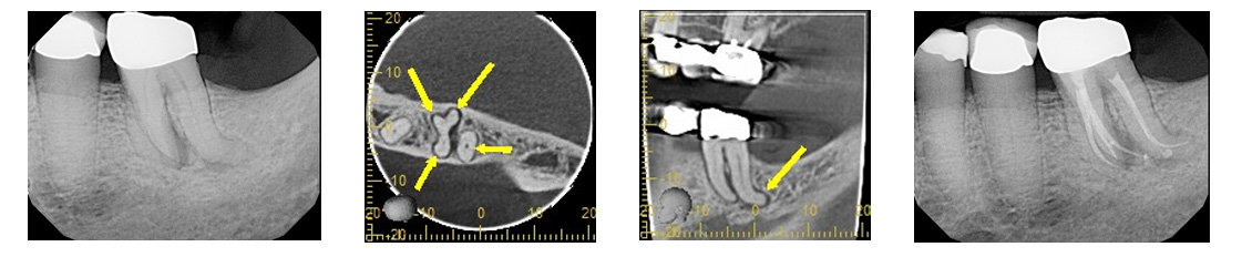 Dental CBCT Scan in El Paso, TX | Westside Endodontic Associates