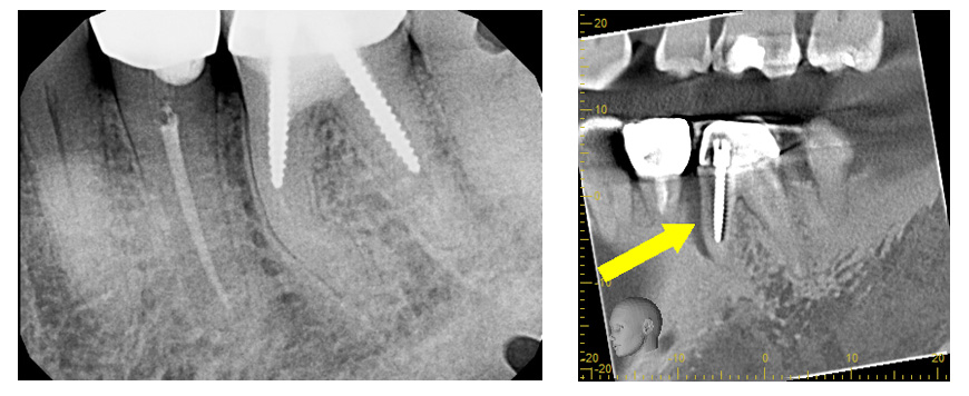 Dental CBCT Scan in El Paso, TX | Westside Endodontic Associates